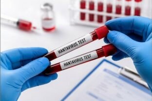 Hantavirus Blood Test Tube with Purple Graphic by GFX_Creatives ...