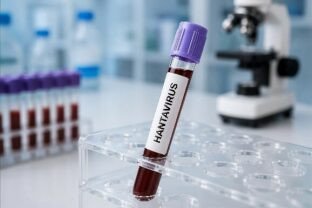Hantavirus Blood Test Tube with Purple Graphic by GFX_Creatives ...